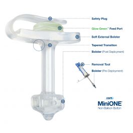 MiniONE Button 24Fr x 2.4cm